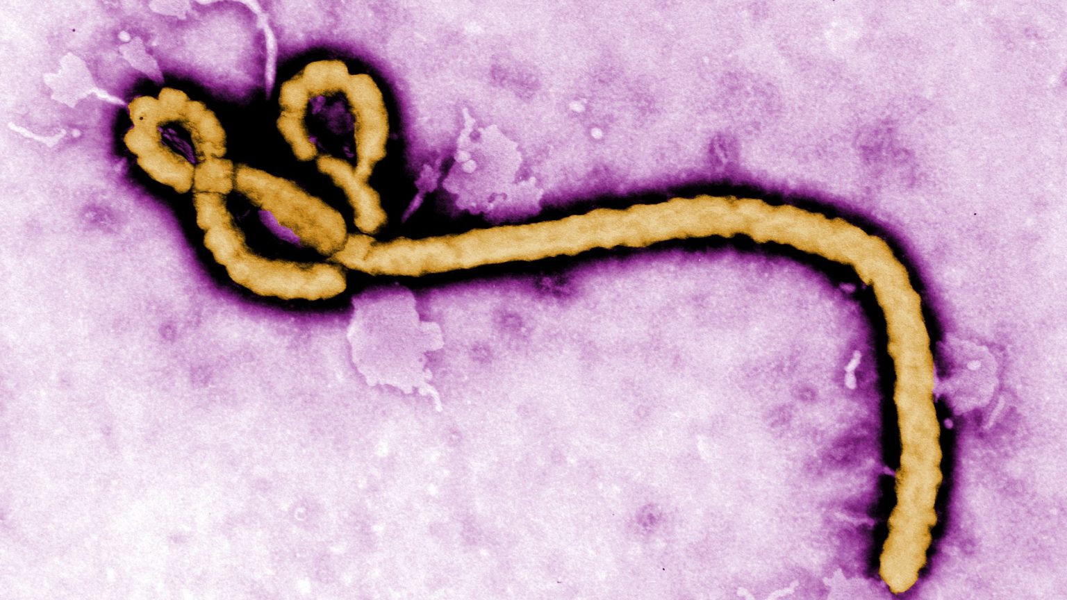 About EBOLA - Rwanda Biomedical Centre